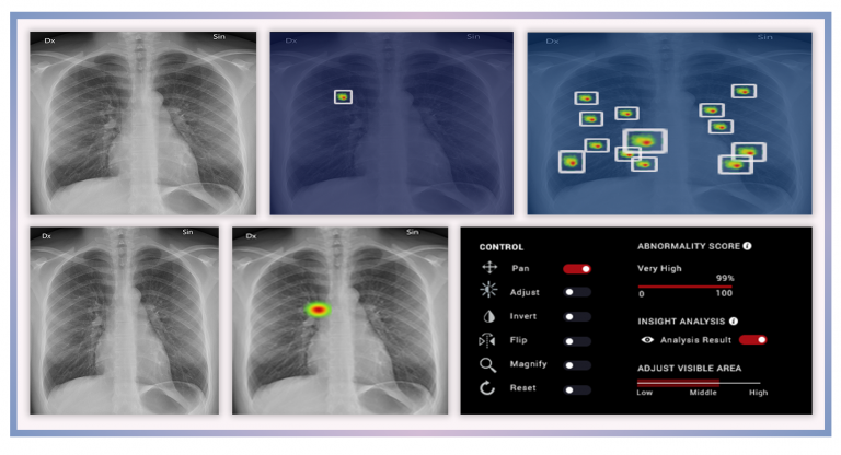 Remote Patient Monitoring – a Fad or the New Reality?