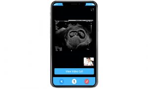 How Do Radiology Information Systems Fit Into Broader Hospital Systems